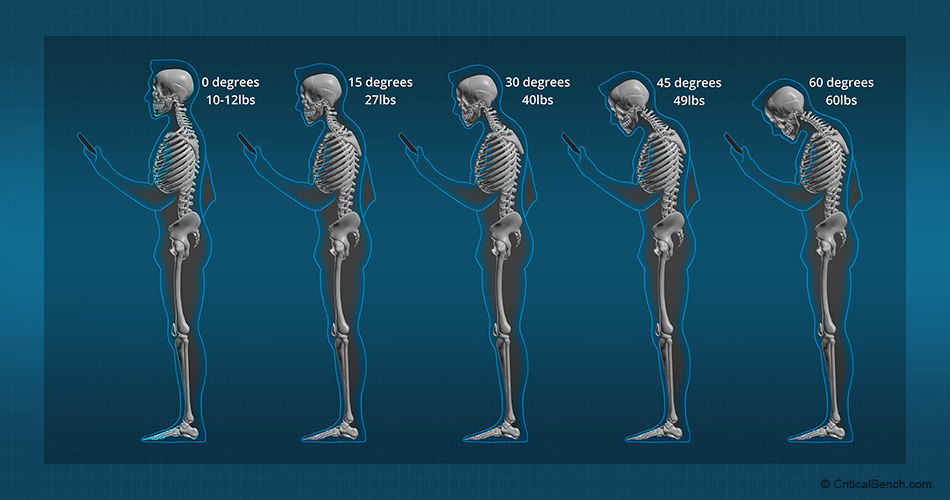 Bad Posture Back Pain Heart Health Belly Fat Diet Food Bad Posture Back Pain Heart Health Belly Fat Diet Food